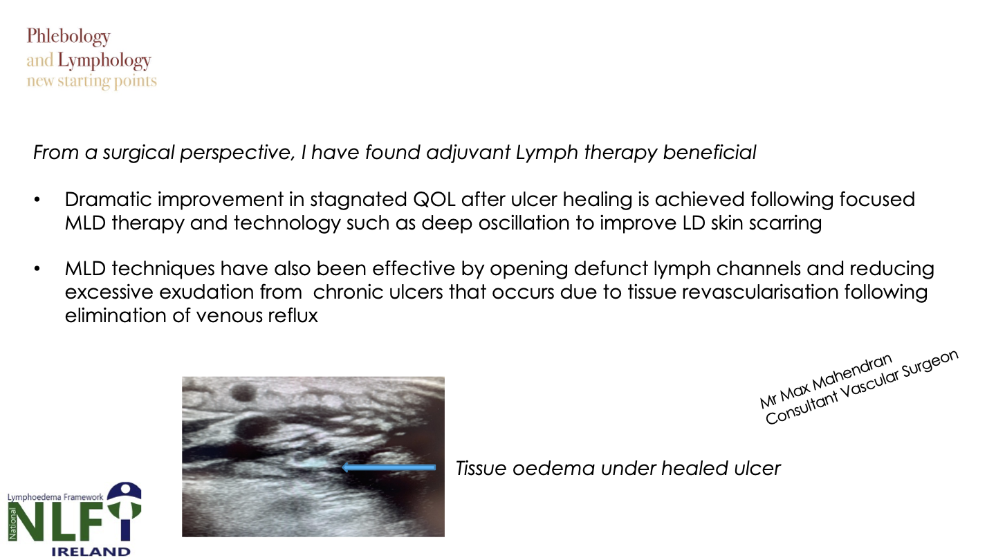 PhysioPod Review of The National Lymphoedema Framework Ireland (NLFI ...