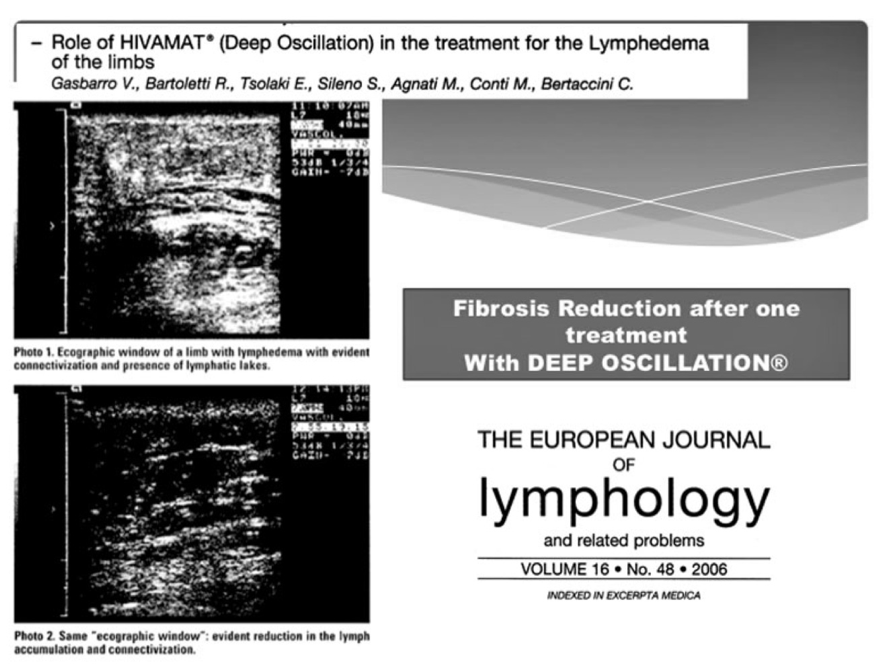 DEEP OSCILLATION® - 'Making a difference to those living with ...