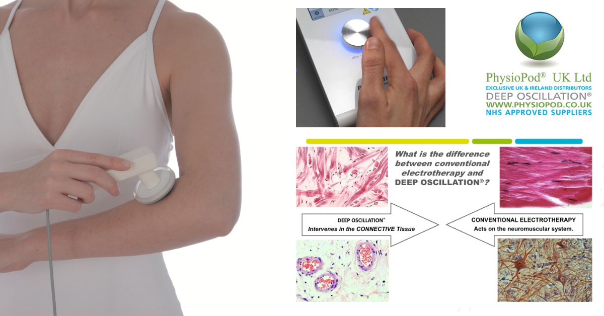 Distal Radius Fracture: Adding Daily Deep Oscillation To The Healing ...