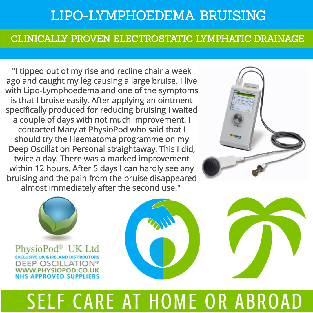 Bruising in Lipo-Lymphoedema | PhysioPod UK Ltd | Exclusive UK ...
