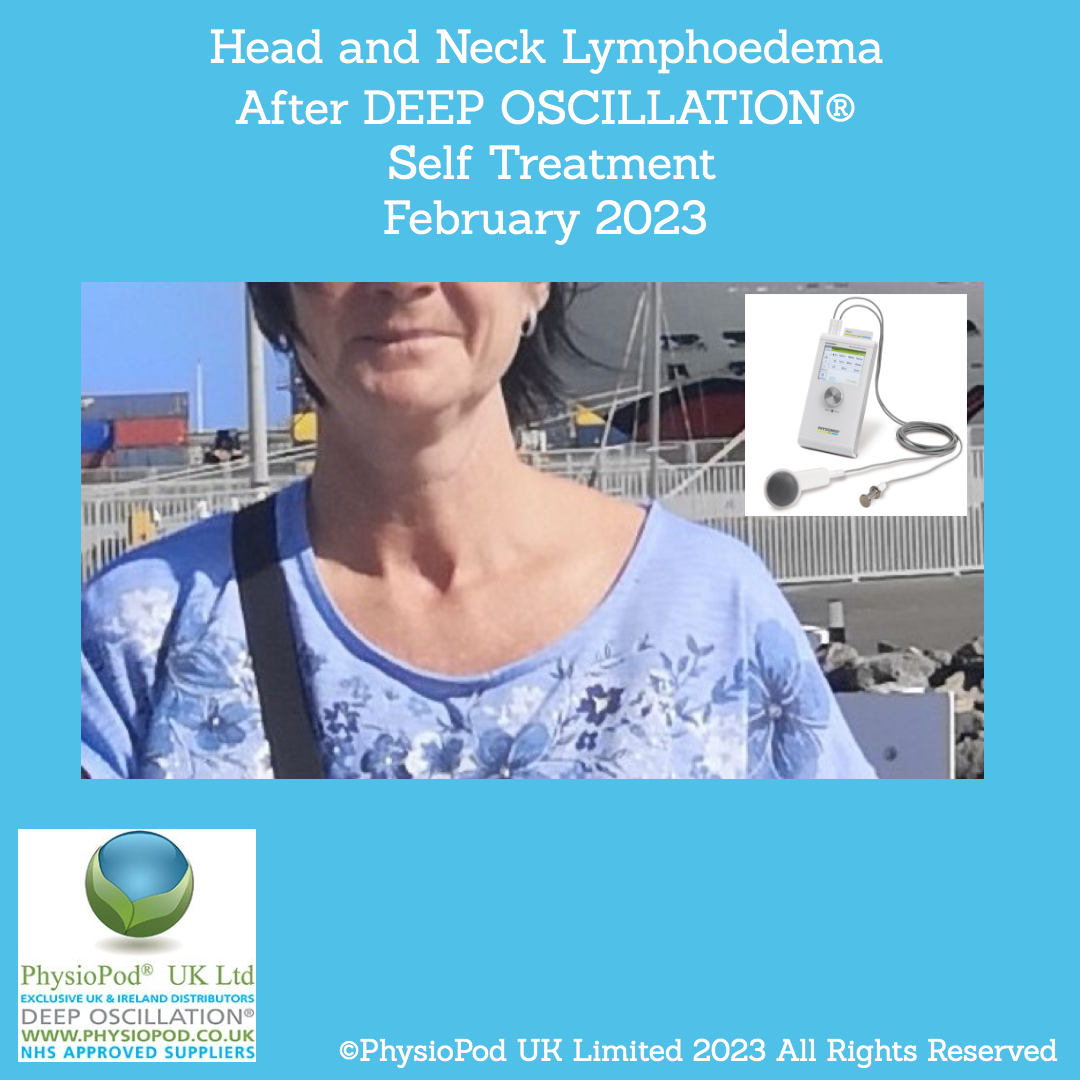 Head and Neck Lymphoedema - Deep Oscillation at Home | PhysioPod UK Ltd ...