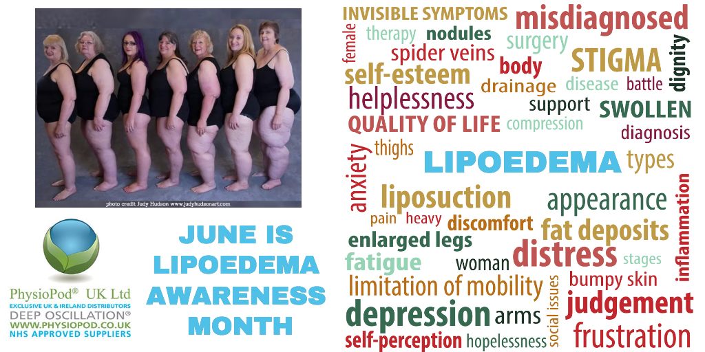 DID YOU KNOW JUNE IS LIPOEDEMA AWARENESS MONTH? | PhysioPod UK Ltd ...