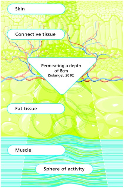 Effect of Sea Urchin Sting in Lower Limb Primary Lymphoedema and ...