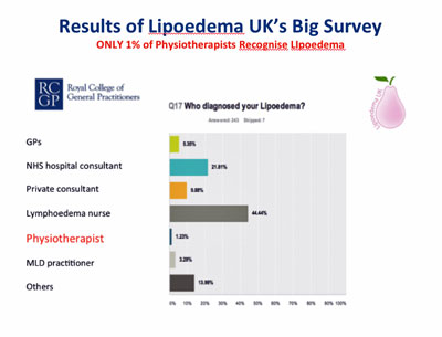 Lipoedema (Lipedema) | PhysioPod UK Ltd | Exclusive UK & Ireland ...