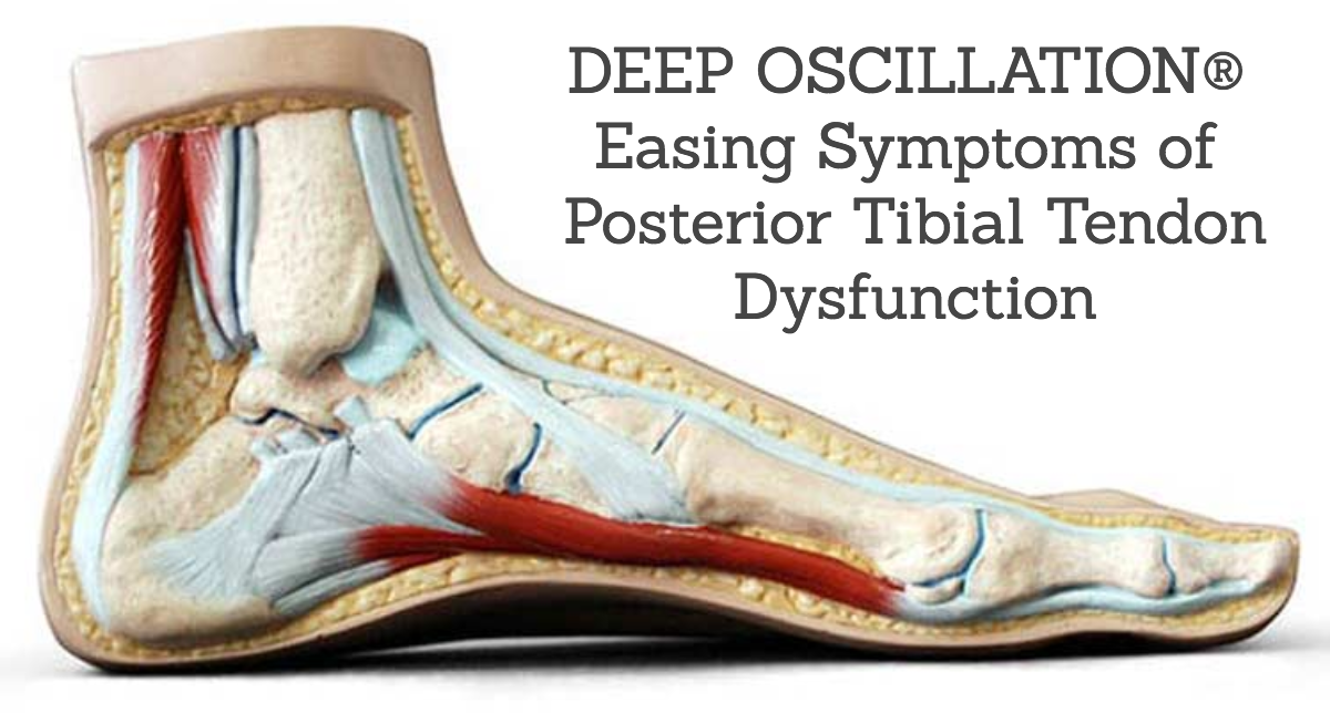 Patient & Physiotherapist Feedback - DEEP OSCILLATION® Easing Symptoms ...